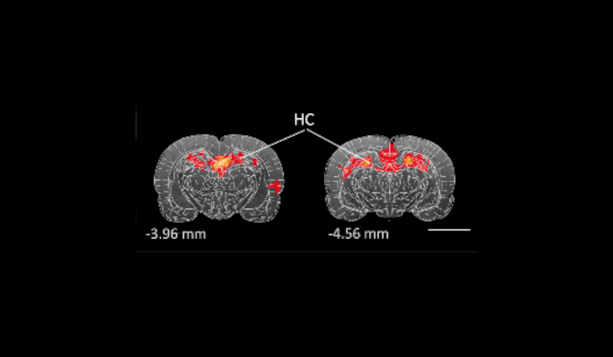 Finding influential nodes for integration in brain networks using optimal percolation theory ...