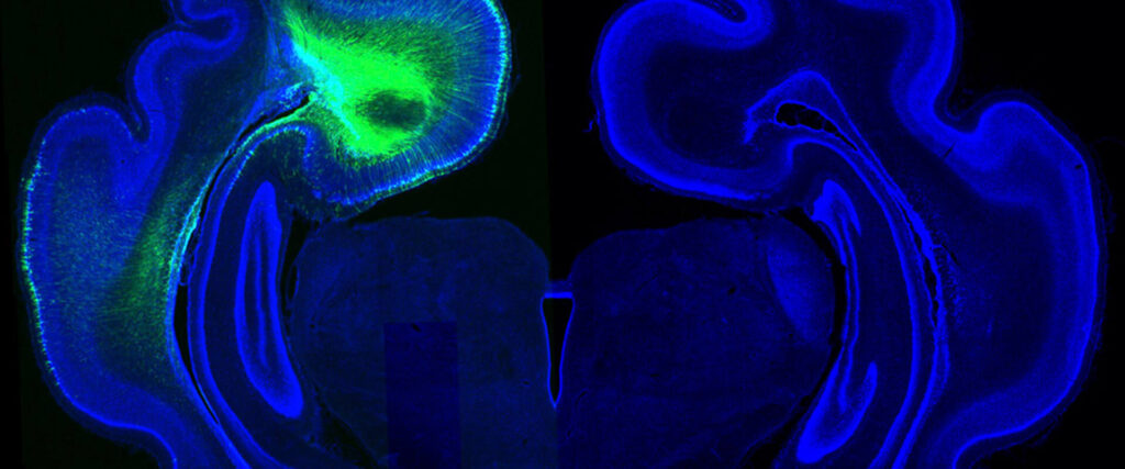 Developmental mechanisms of gyrification. - Instituto de Neurociencias ...